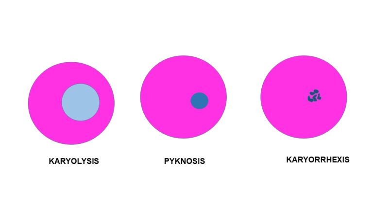 MORPHOLOGY OF IRREVERSIBLE CELL INJURY: Cytoplasmic and Nuclear Changes ...