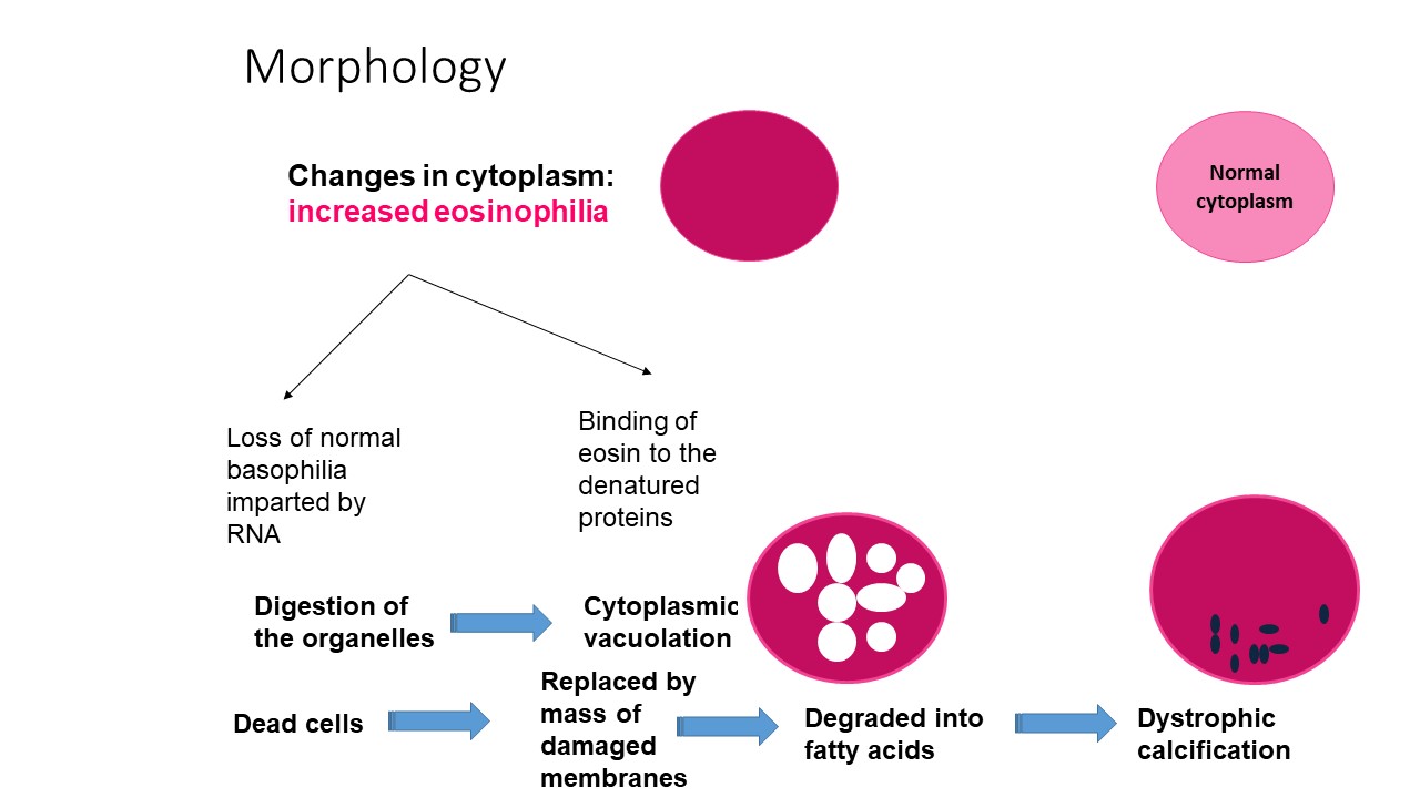MORPHOLOGY OF IRREVERSIBLE CELL INJURY: Cytoplasmic and Nuclear Changes ...