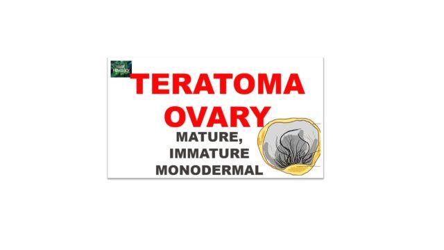 Ovarian Teratoma - Pathology Made Simple