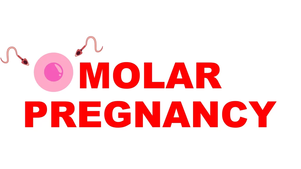 Gestational Trophoblastic Diseases: Part 1: Complete and Partial ...