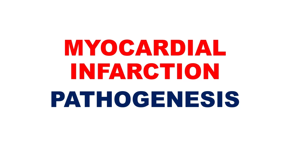 Myocardial Infarction: Pathogenesis and Infarct Types - Pathology Made ...