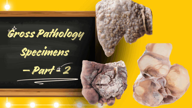 Gross Pathology Specimen Series – Part 2 - Pathology Made Simple
